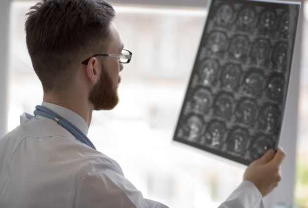 TCE leve: conheça novas diretrizes do CDC para tratamento em crianças ...