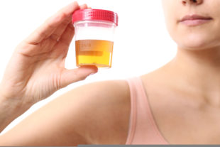 Orientações ao paciente: como evitar a contaminação da amostra na ...