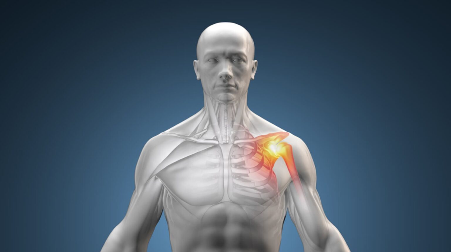 Síndrome de Parsonage Turner: como conduzir? - Portal Afya