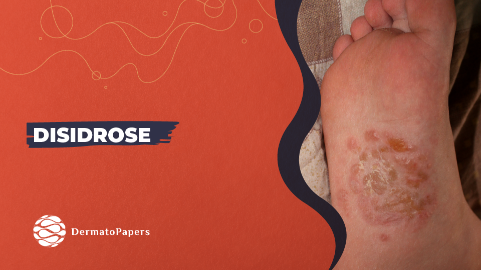 Podcast Dermatopapers: Disidrose - Portal Afya