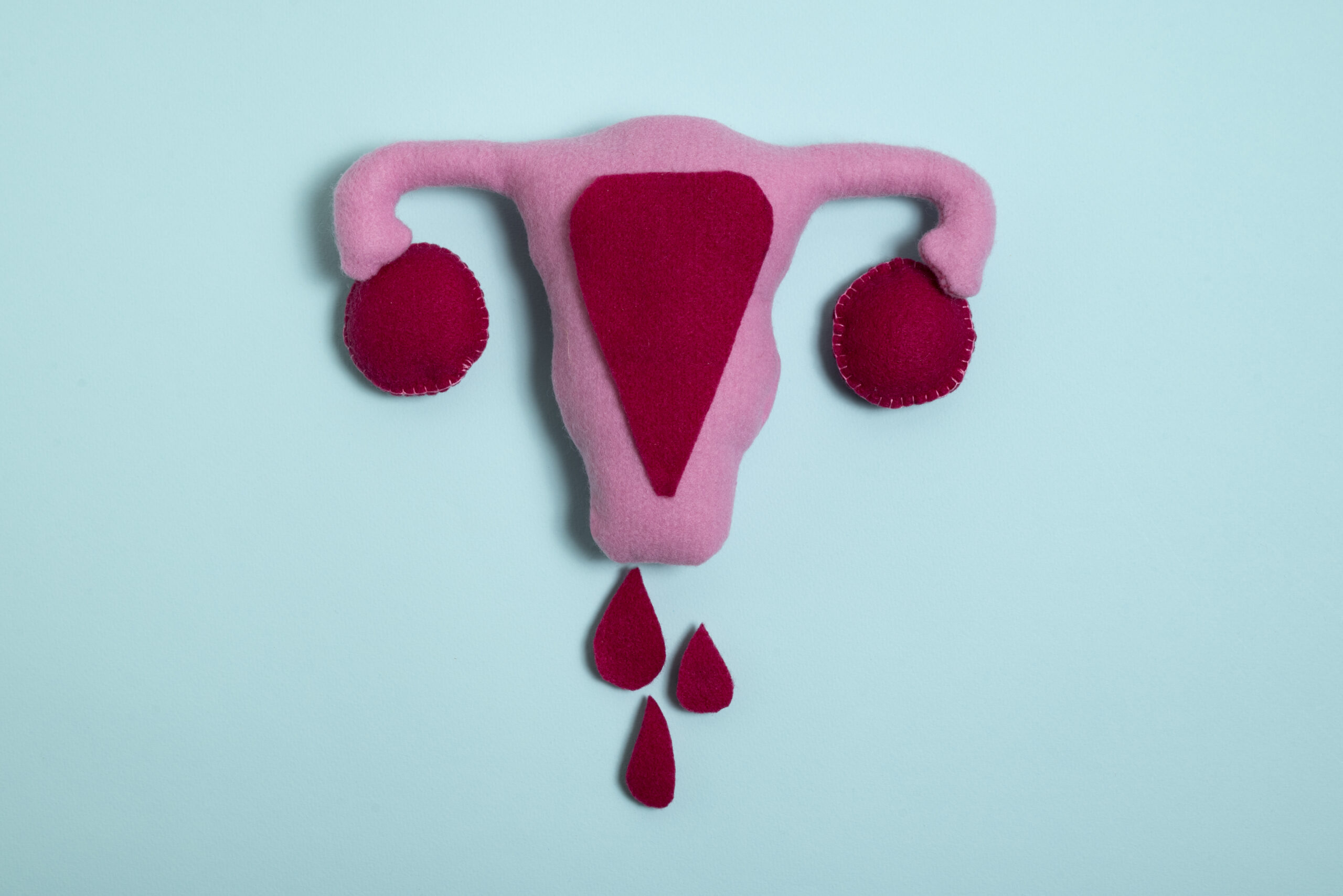 Diagnóstico por imagem do sangramento uterino anormal - Portal Afya