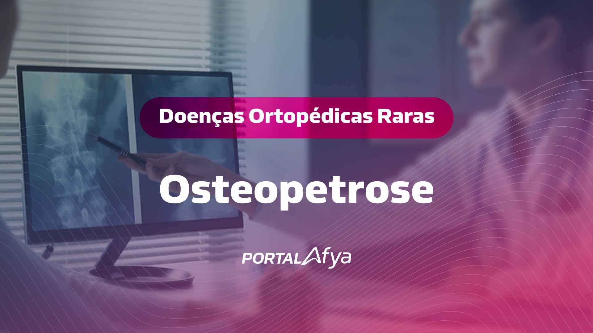 Podcast #153: Série Doenças Ortopédicas Raras: Osteopetrose - Portal Afya