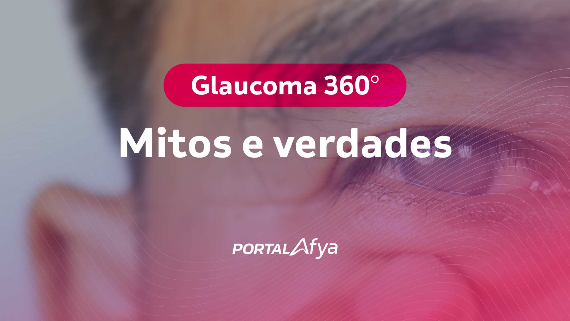 Glaucoma 360º: Desvendando mitos e verdades com a Ciência [vídeo ...